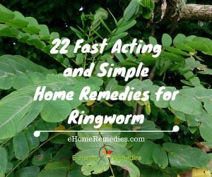 22 Fast Acting & Simple Home Remedies For Ringworm